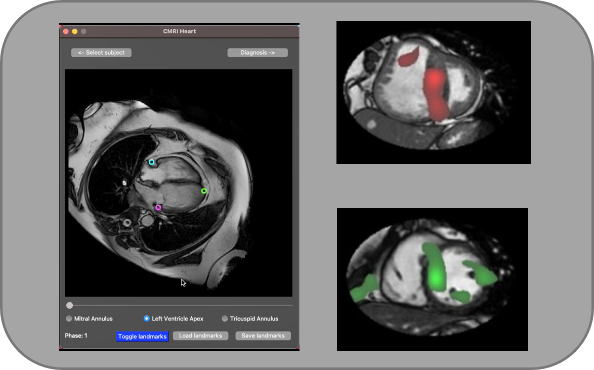 Interpretable ML for Cardiac MRI | Haiping Lu